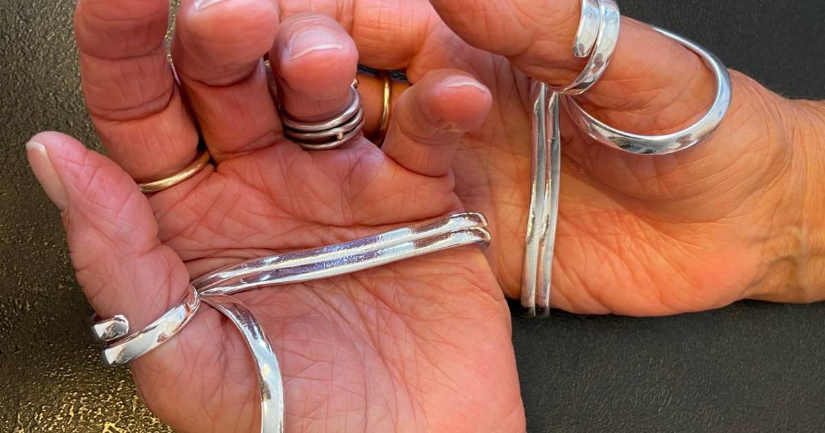 Silversplints gør en stor forskel for dig med hypermobilitet og gigt ...